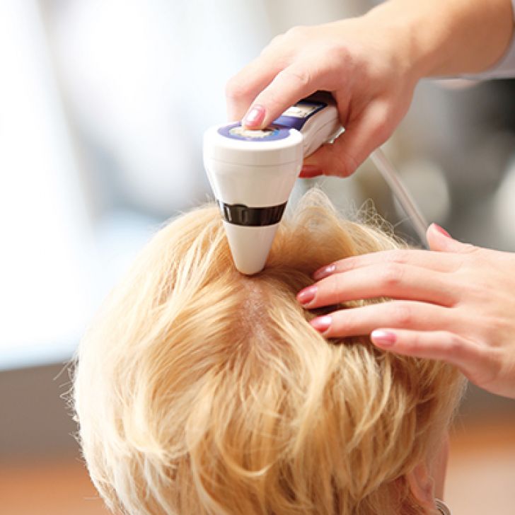 Nieuwe haargroei na haaruitval? | Advies bij haaruitval | Confident ...