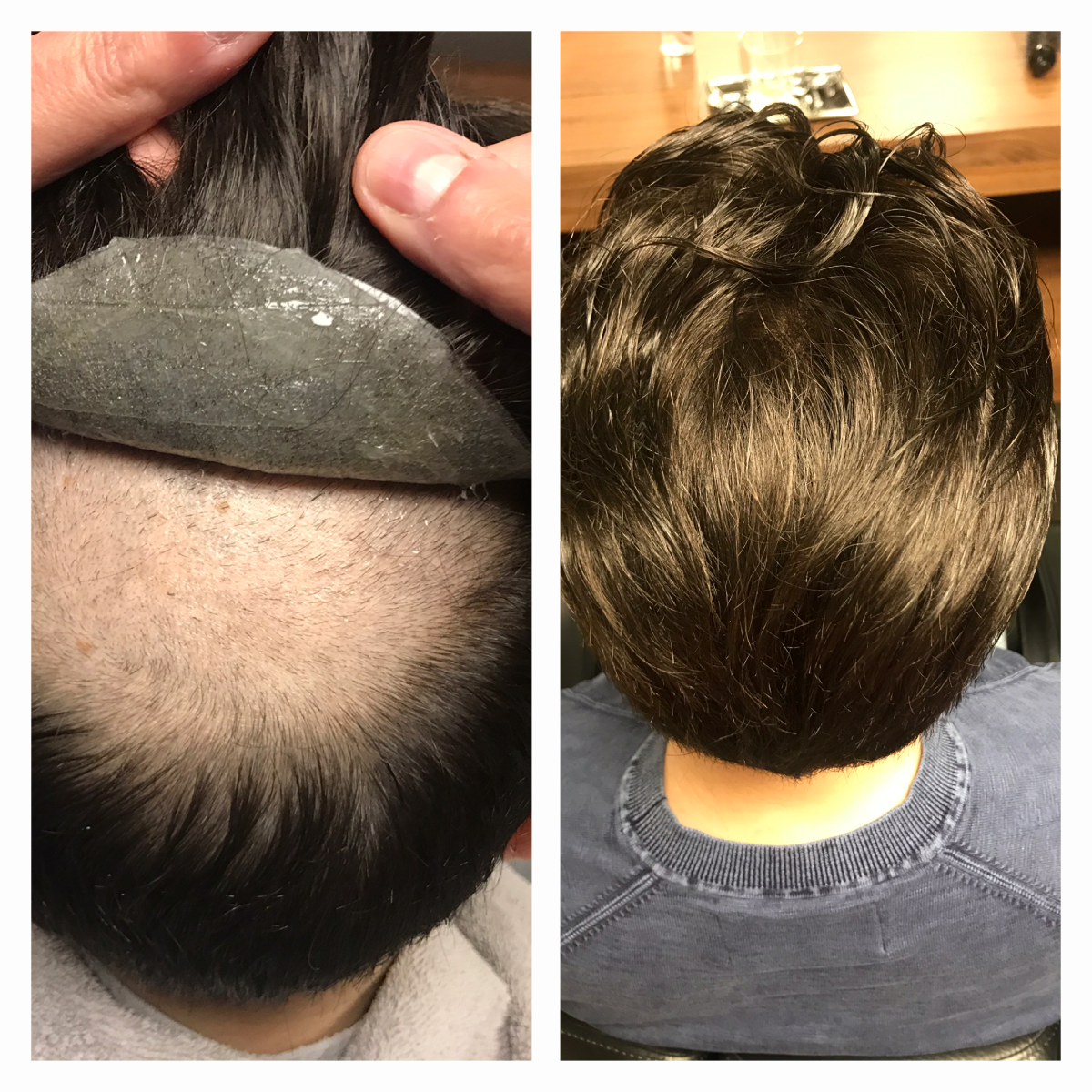 Dunner wordend haar man | Advies | Confident Haarzorg | Confident Haarzorg